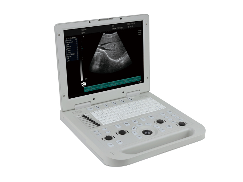 SS-10 Full Digital Laptop Ultrasound Scanner-SonoStar-Manufacturer of ...