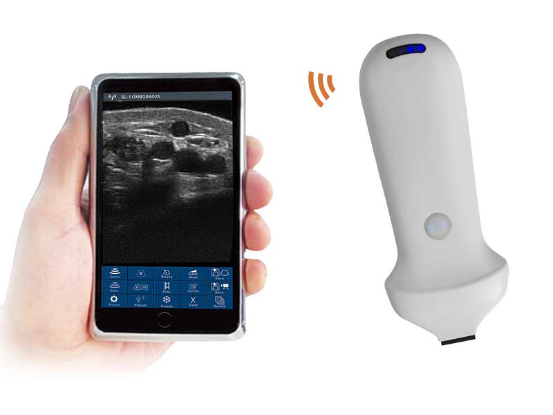 Wireless Mini Ultrasounder